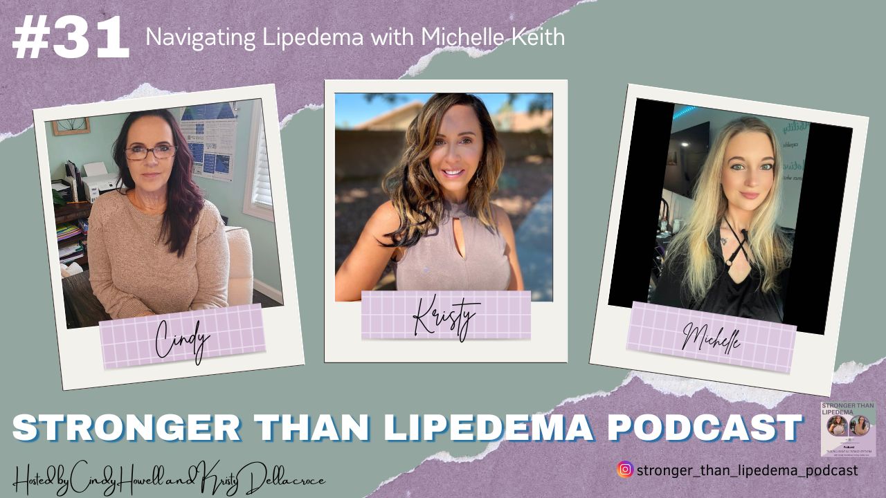 Navigating Lipedema with Michelle Keith - withcindyhowell